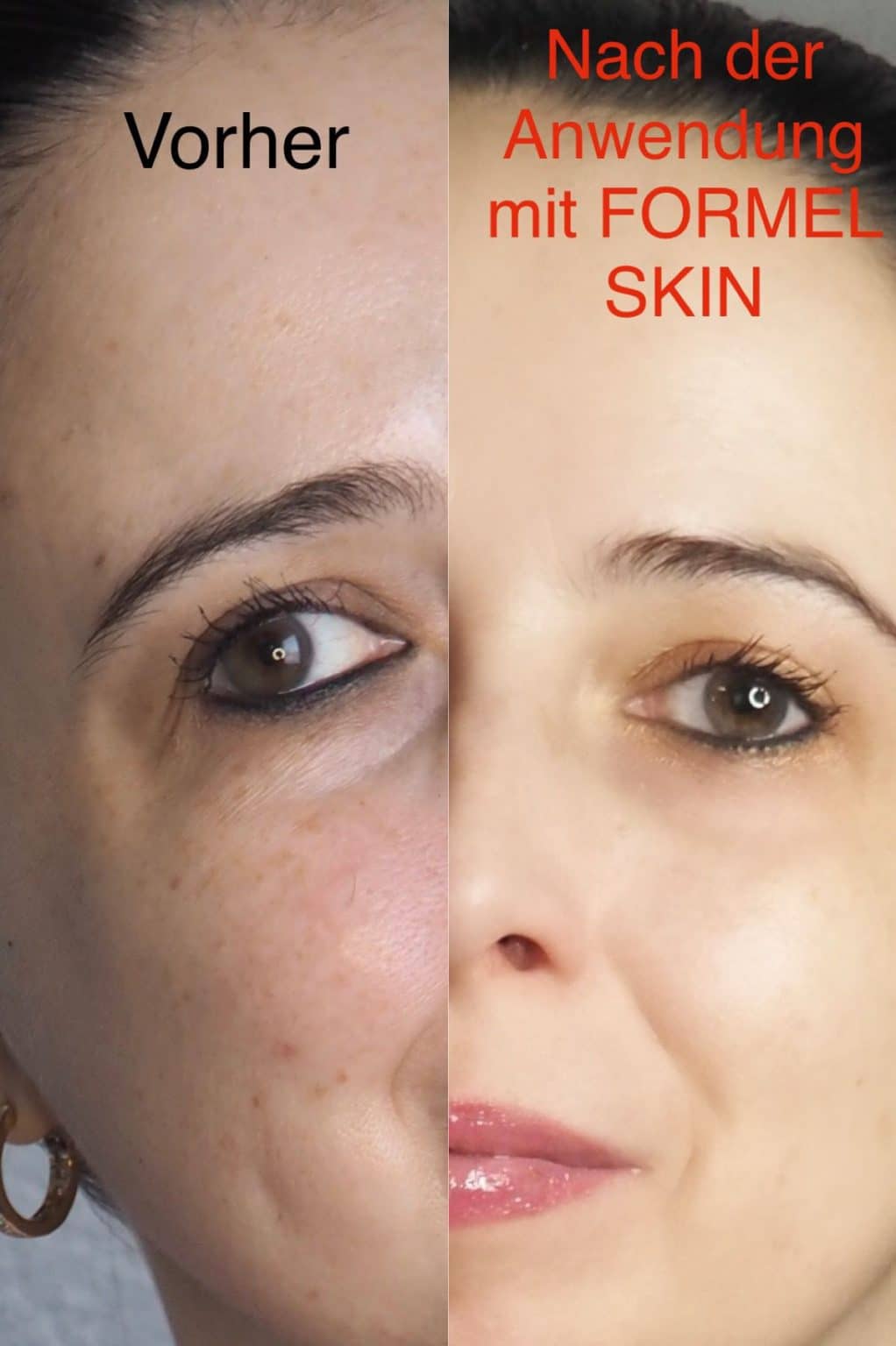 Formel Skin: New Year - new me! - Label Love